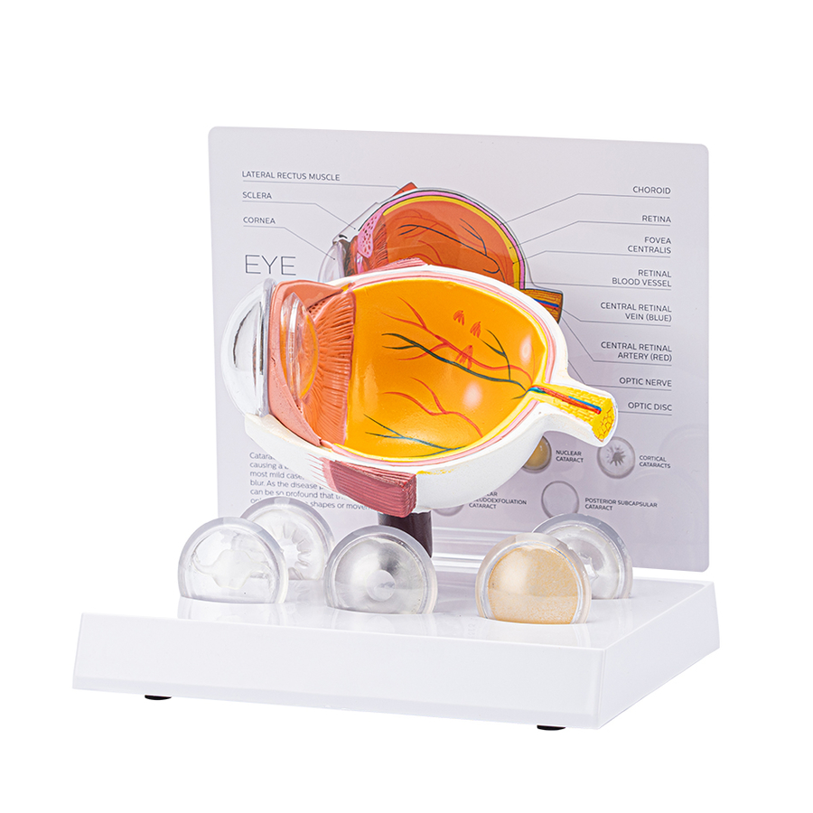 Anatomical Eye Model | 5X Magnified Human Eyeball Anatomy Chart for ...